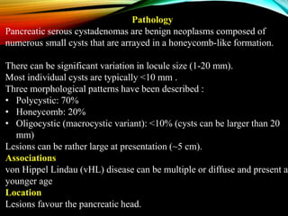 IMAGING OF CYSTIC PANCREATIC TUMOURS | PPTX