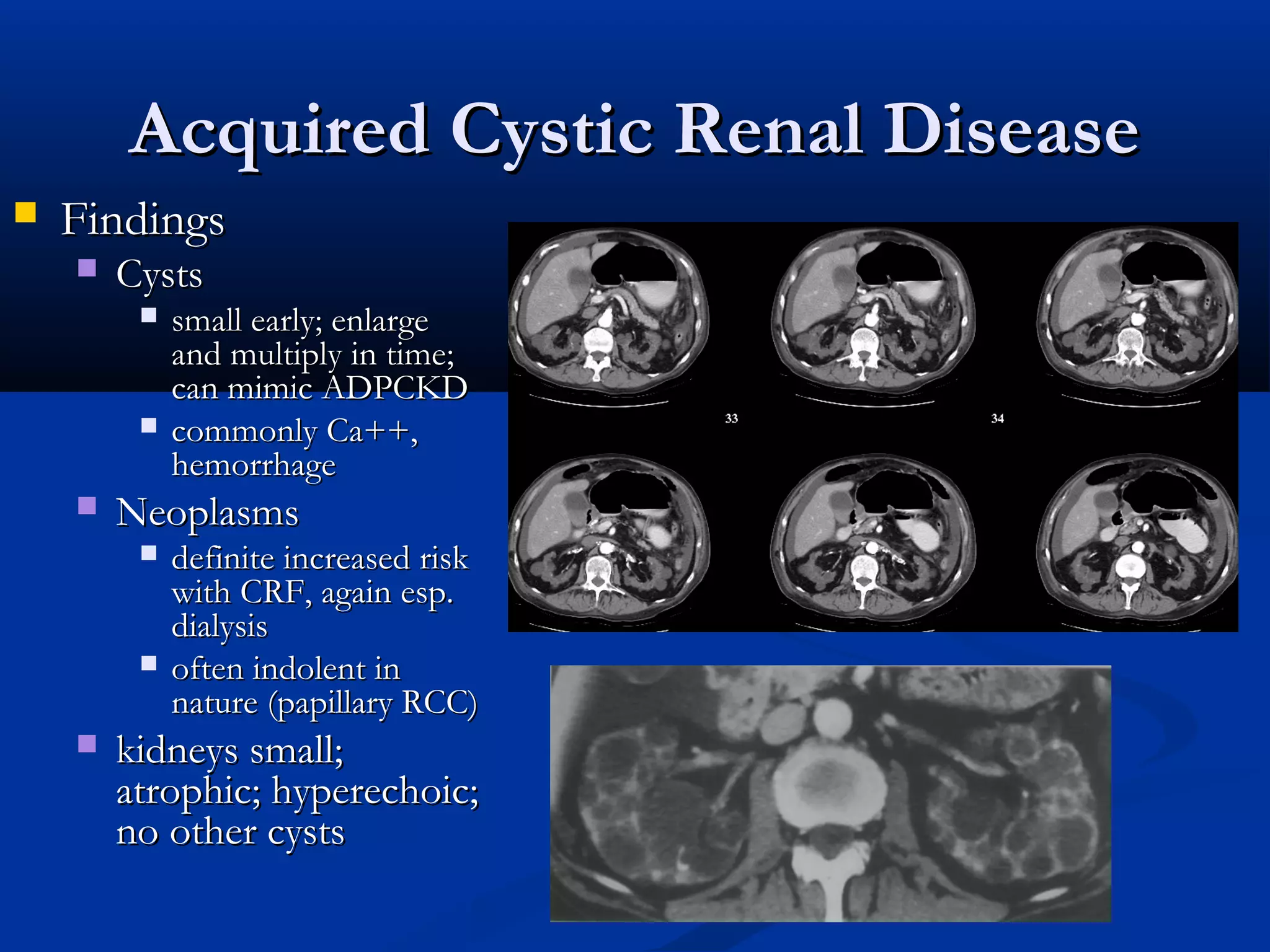 Cystic Renal Disease | PPT