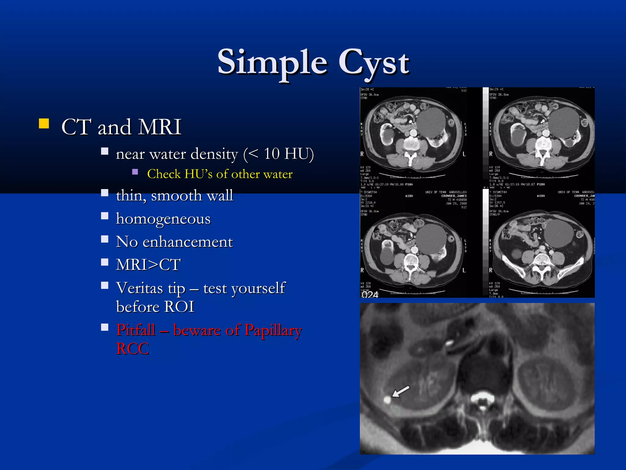 Cystic Renal Disease | PPT