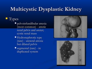 Cystic Renal Disease | PPT
