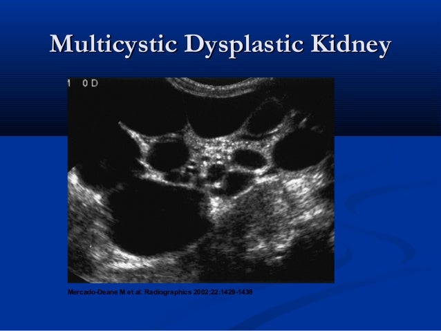 Cystic Renal Disease