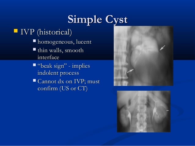 Cystic Renal Disease
