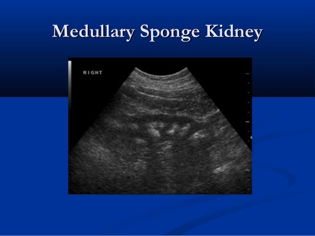 Cystic Renal Disease