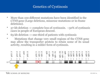 cystinosis-Introduction, diagnosis and management | PPTX