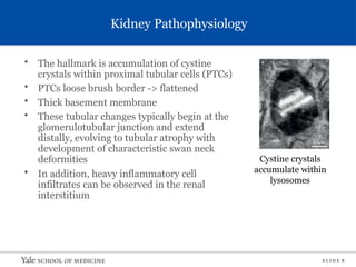 cystinosis-Introduction, diagnosis and management | PPTX