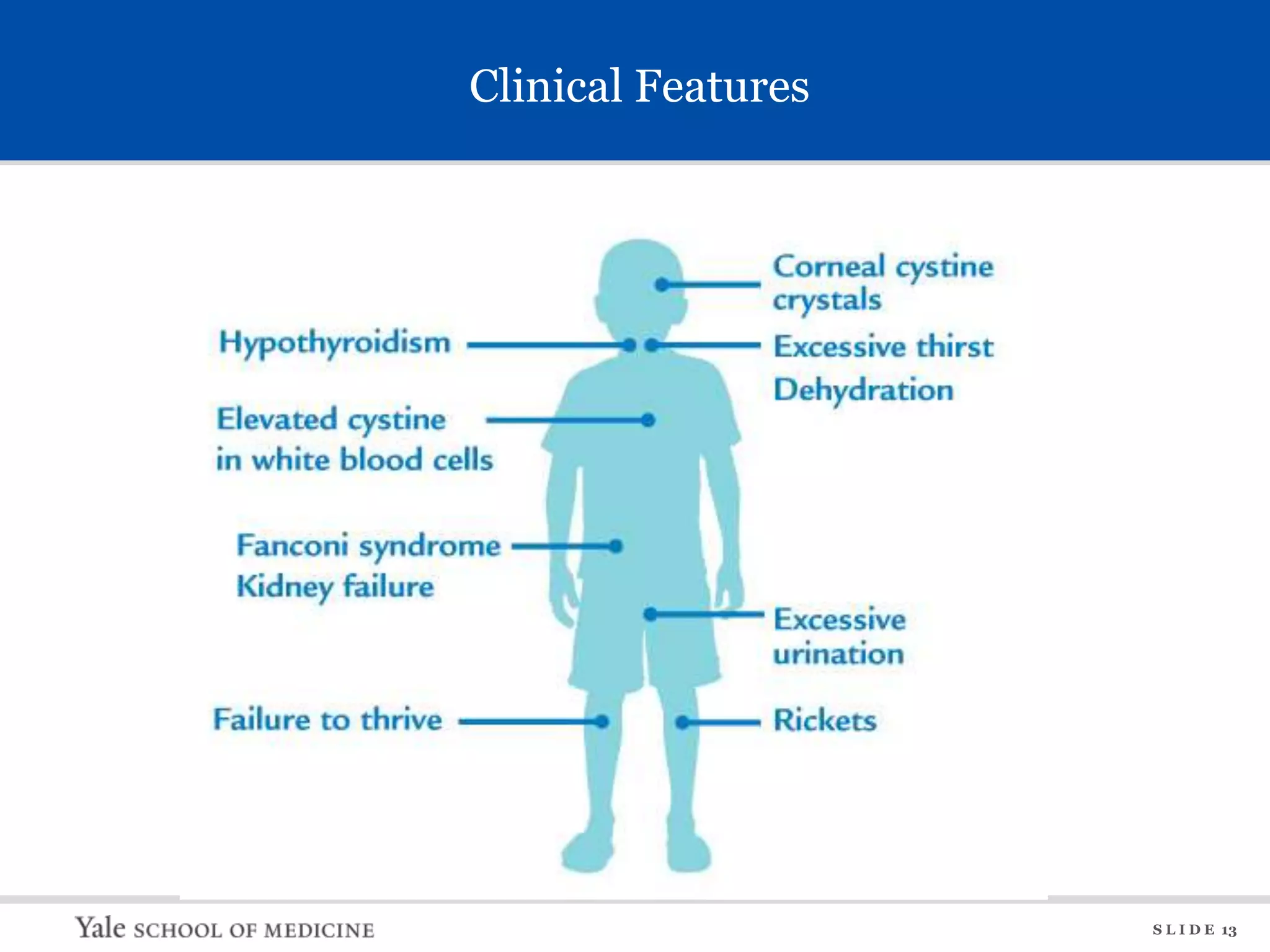 Cystinosis.pptx