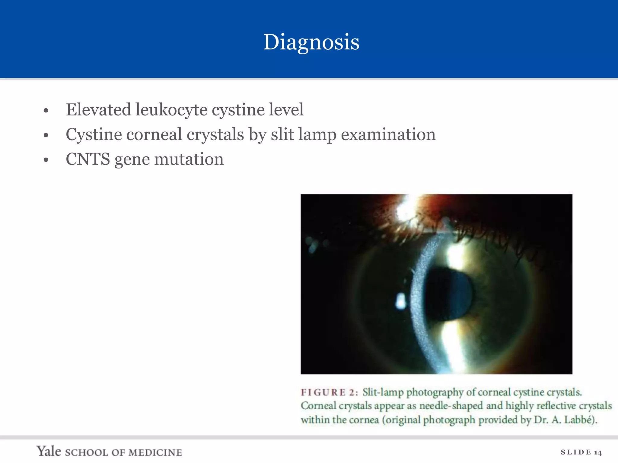 Cystinosis.pptx