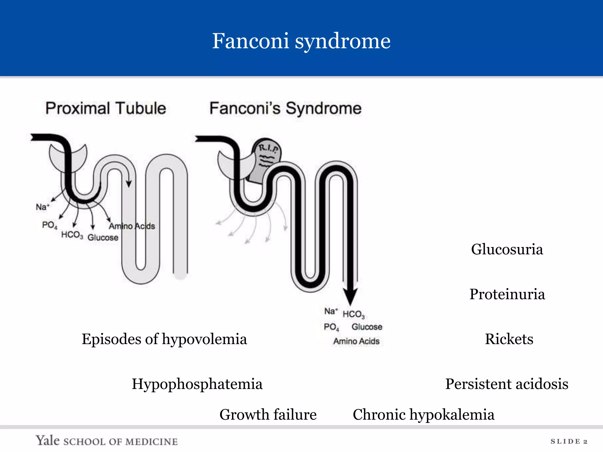 Cystinosis.pptx