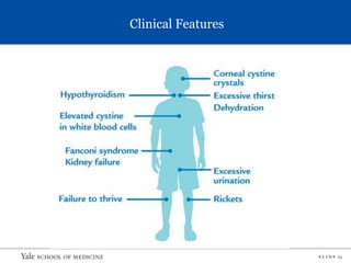 Cystinosis.pptx