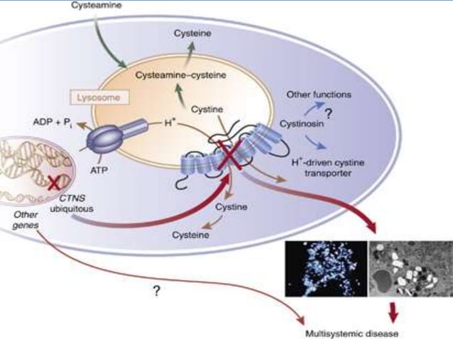 Cystinosis.pptx | Free Download