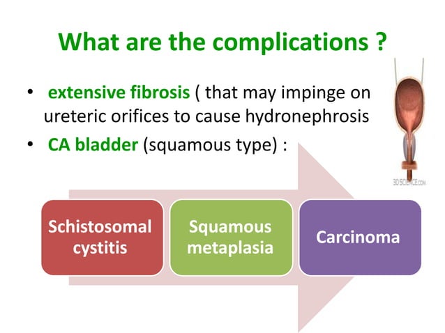 Cystitis made easy | PPTX