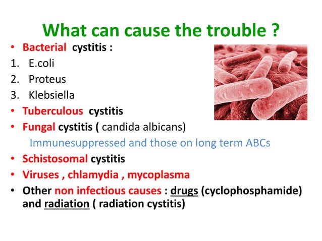 Cystitis made easy | PPTX