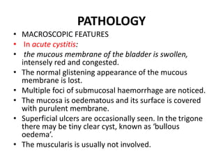 CYSTITIS.pptx