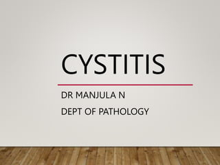 cystitis.pptx