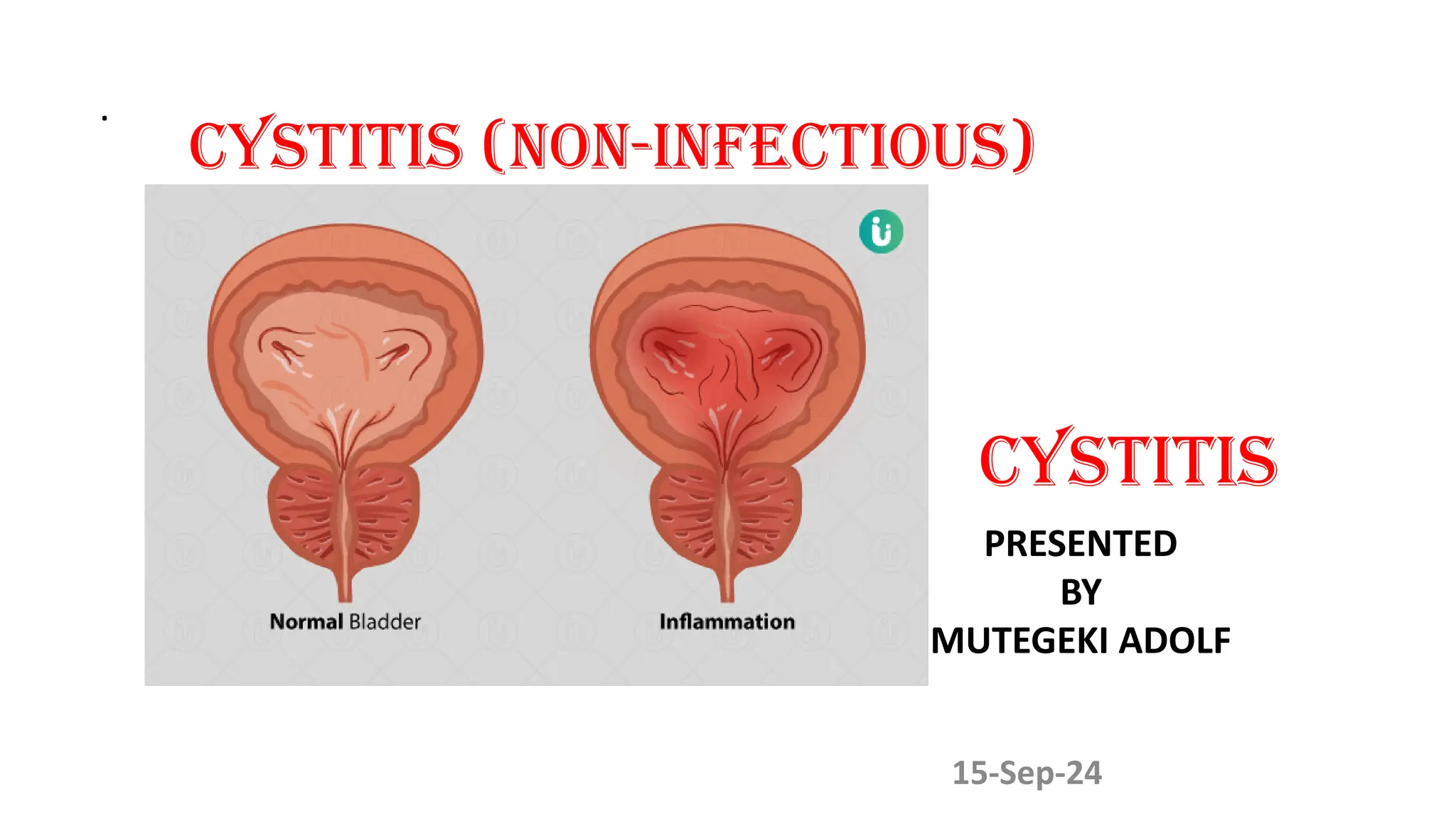 CYSTITIS, Inflamation of the bladder, the organ that store urine | PDF ...