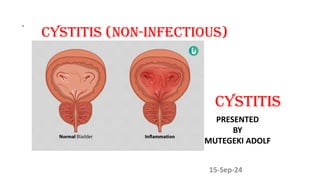 CYSTITIS, Inflamation of the bladder, the organ that store urine | PDF ...
