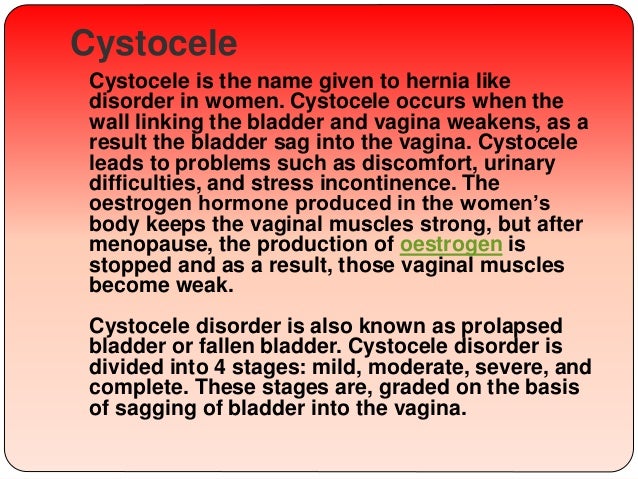 Cystocele