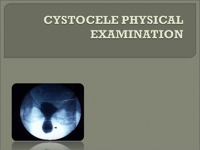 Cystocele Grading