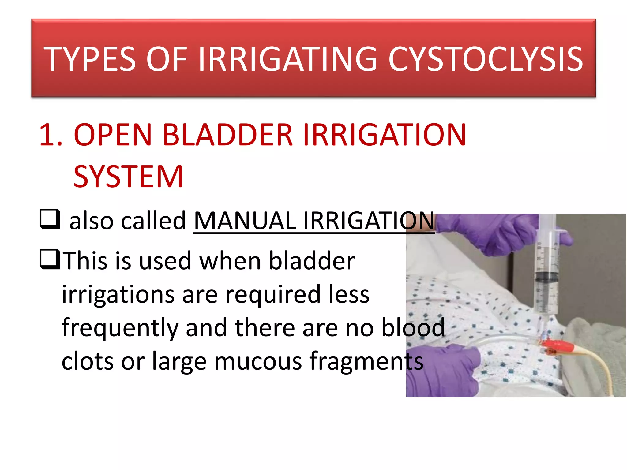 Cystoclysis bladder irrigation | PPTX