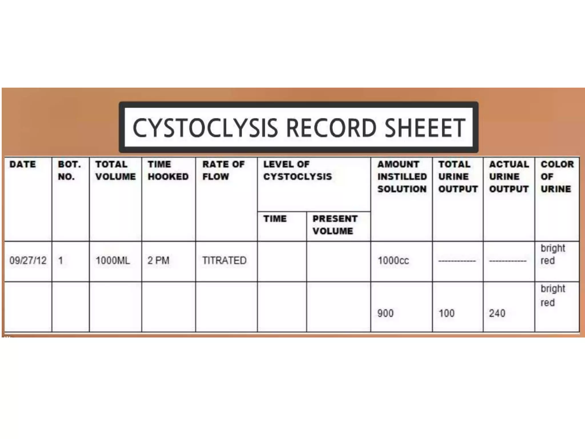 Cystoclysis bladder irrigation | PPTX