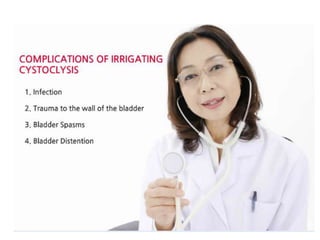 Cystoclysis bladder irrigation | PPTX