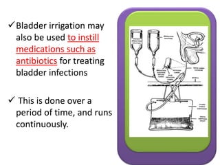 Cystoclysis bladder irrigation | PPTX