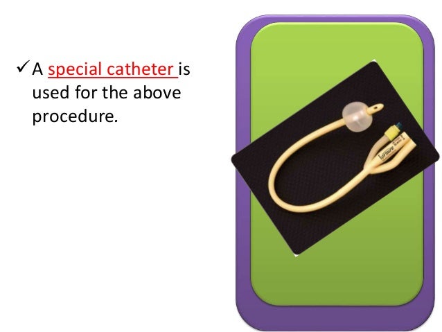 Bladder Irrigation Catheter