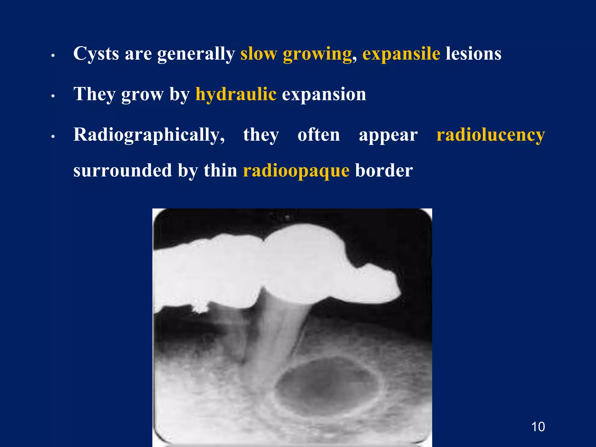 cysts of the oral and maxillofacial region | PPTX