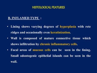 cysts of the oral and maxillofacial region | PPTX
