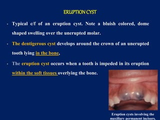 cysts of the oral and maxillofacial region | PPTX