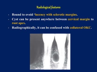 cysts of the oral and maxillofacial region | PPTX
