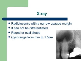 Cyst of jaws and osteomylitis | PPT