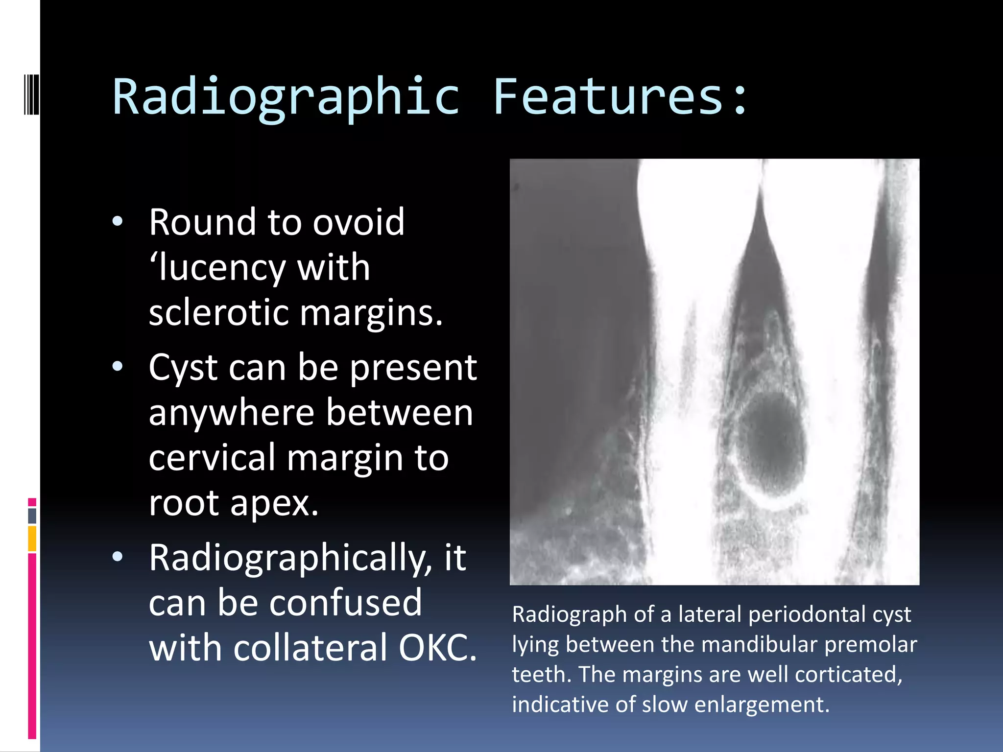 Cysts of the Oral Cavity | PPTX