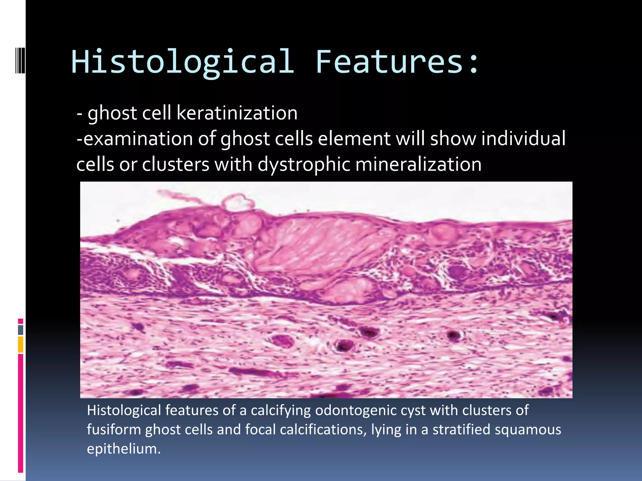 Cysts of the Oral Cavity | PPTX