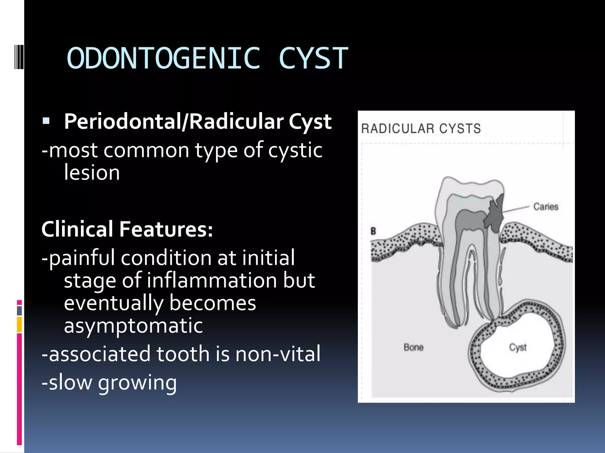 Cysts of the Oral Cavity | PPTX
