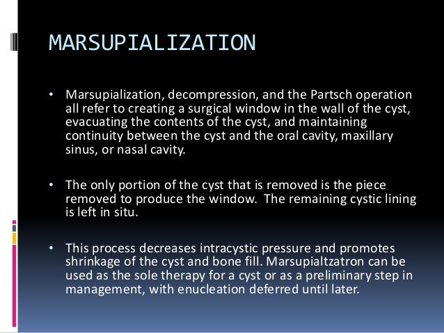 Cysts of the Oral Cavity