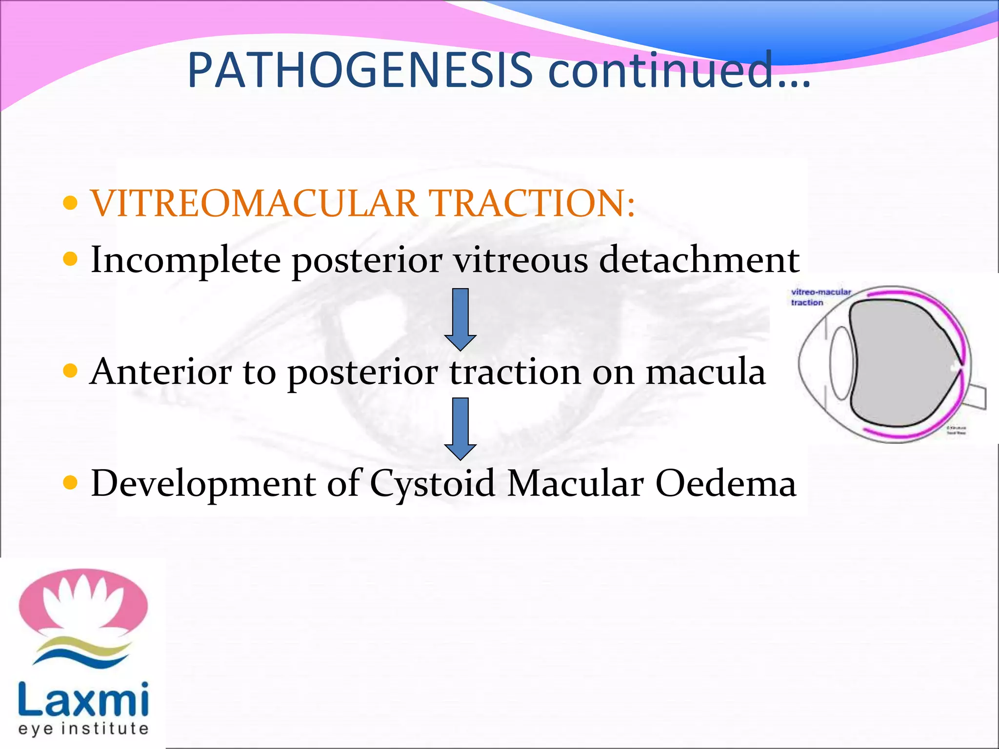 Cystoid macular oedema | PPTX