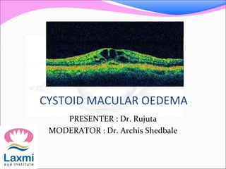 Cystoid Macular Edema