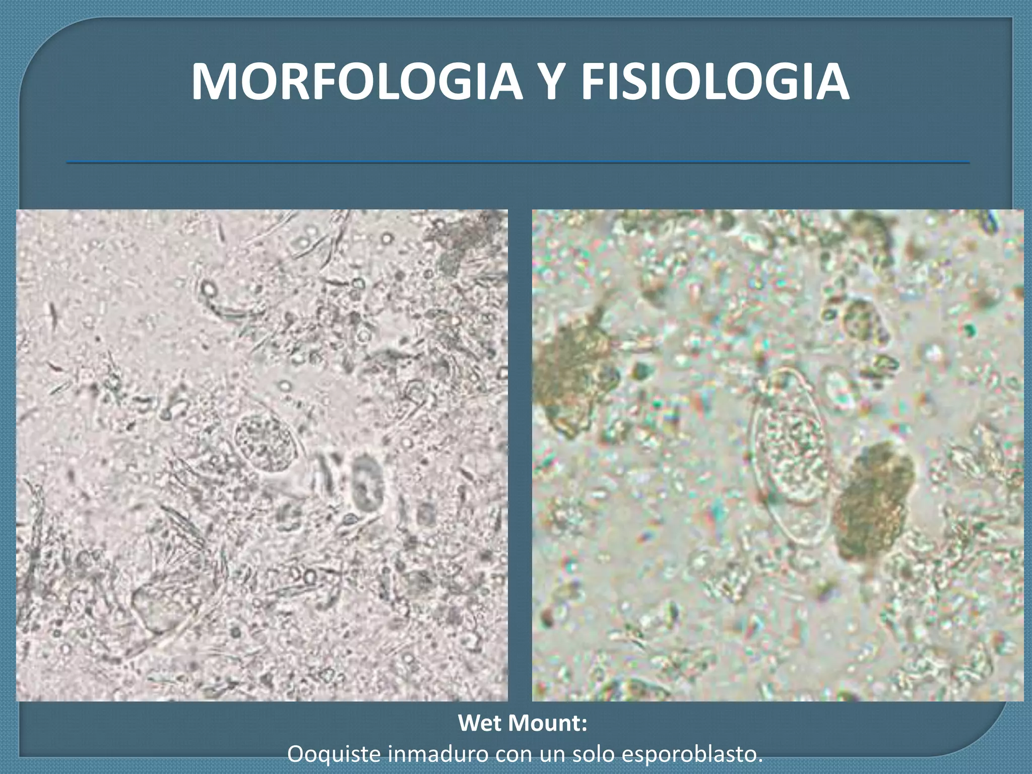 Cystoisospora Belli Pptx