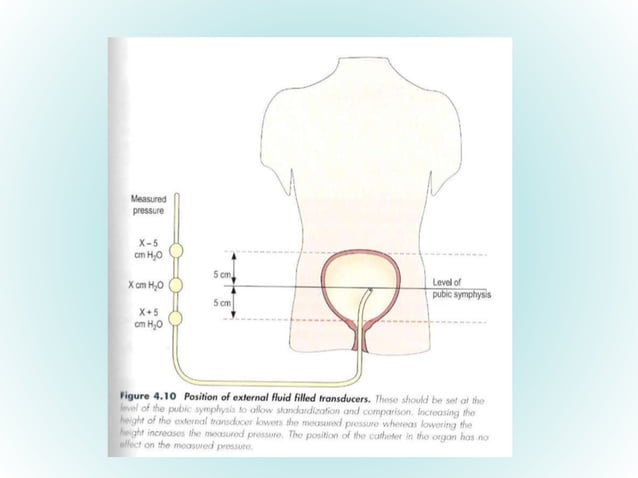 Cystometrogram Storage Phase | PPTX
