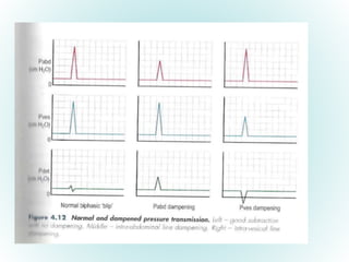 Cystometrogram Storage Phase | PPTX