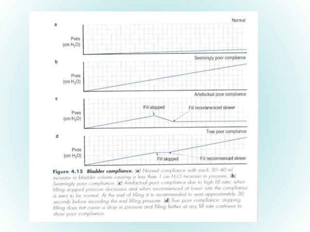 Cystometrogram Storage Phase | PPTX