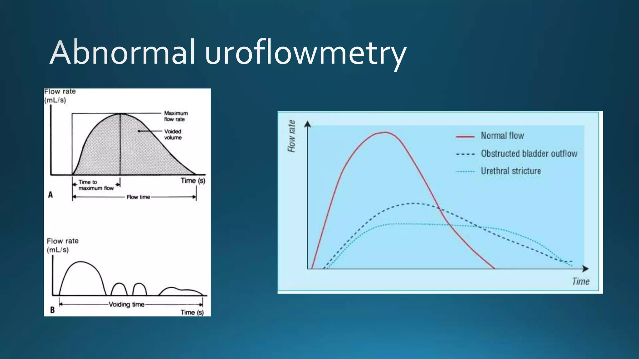 Cystometry and uroflowmetry | PPTX