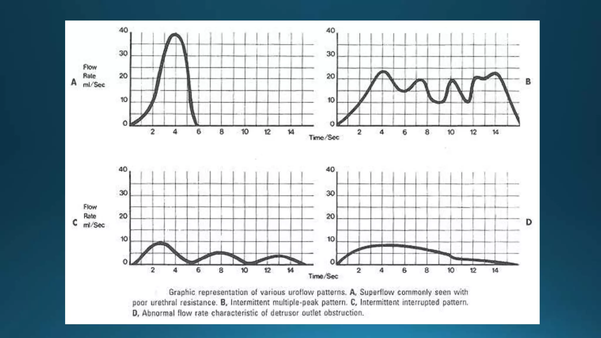Cystometry and uroflowmetry | PPTX