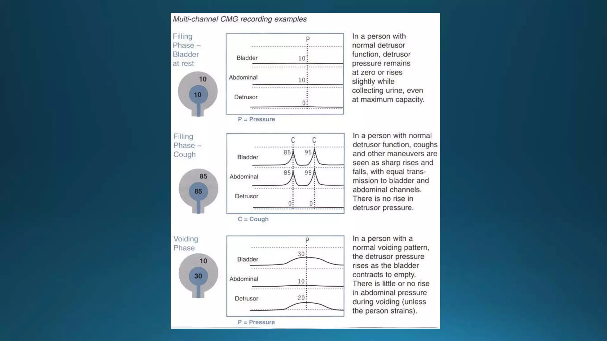 Cystometry and uroflowmetry | PPTX