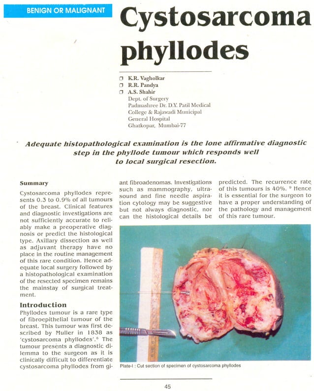 Cystosarcoma phyllodes.