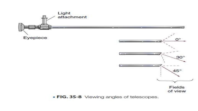 Cystoscopy | PPTX | Surgery | Medical Health