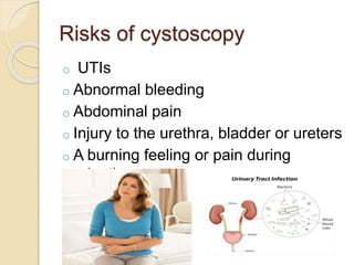 Cystoscopy | PPTX