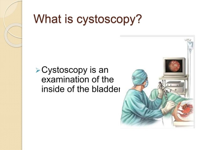 Cystoscopy | PPTX