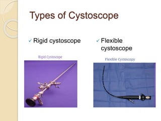 Cystoscopy | PPTX